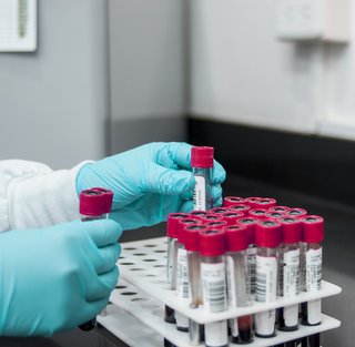 Tests to diagnose and monitor follicular lymphoma | Blood Cancer UK